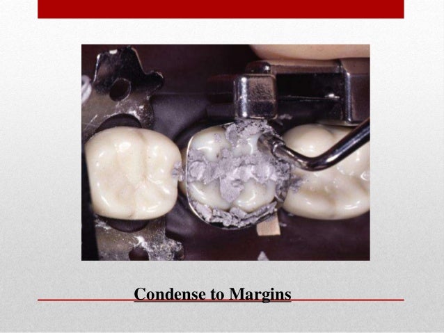 Dental Amalgam Restoration