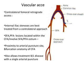 Endovascular Prep Basic | PPT