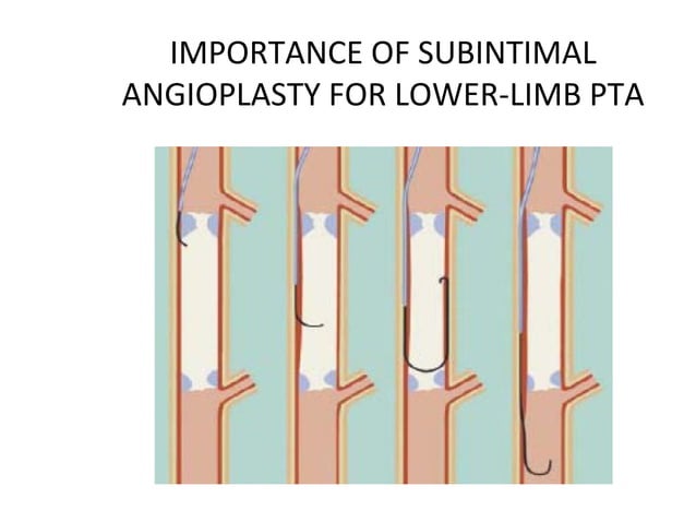 Endovascular Prep Basic | PPT | Surgery | Medical Health