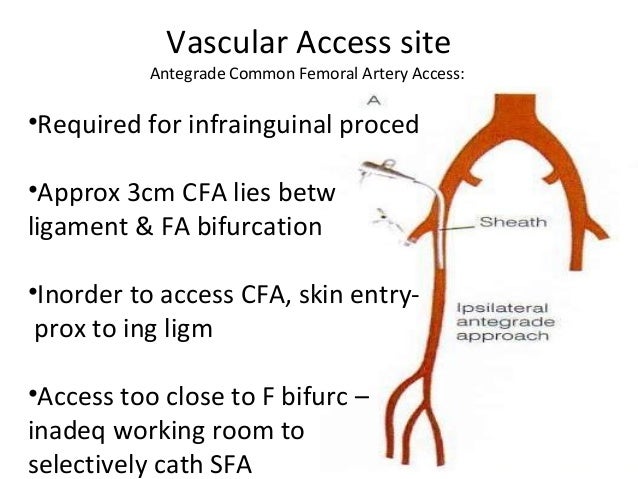 Endovascular Prep Basic