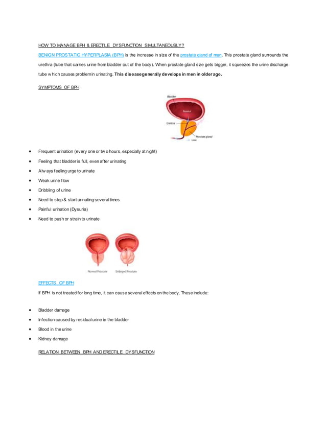 HOW TO MANAGE BPH & ERECTILE DYSFUNCTION SIMULTANEOUSLY? | PDF