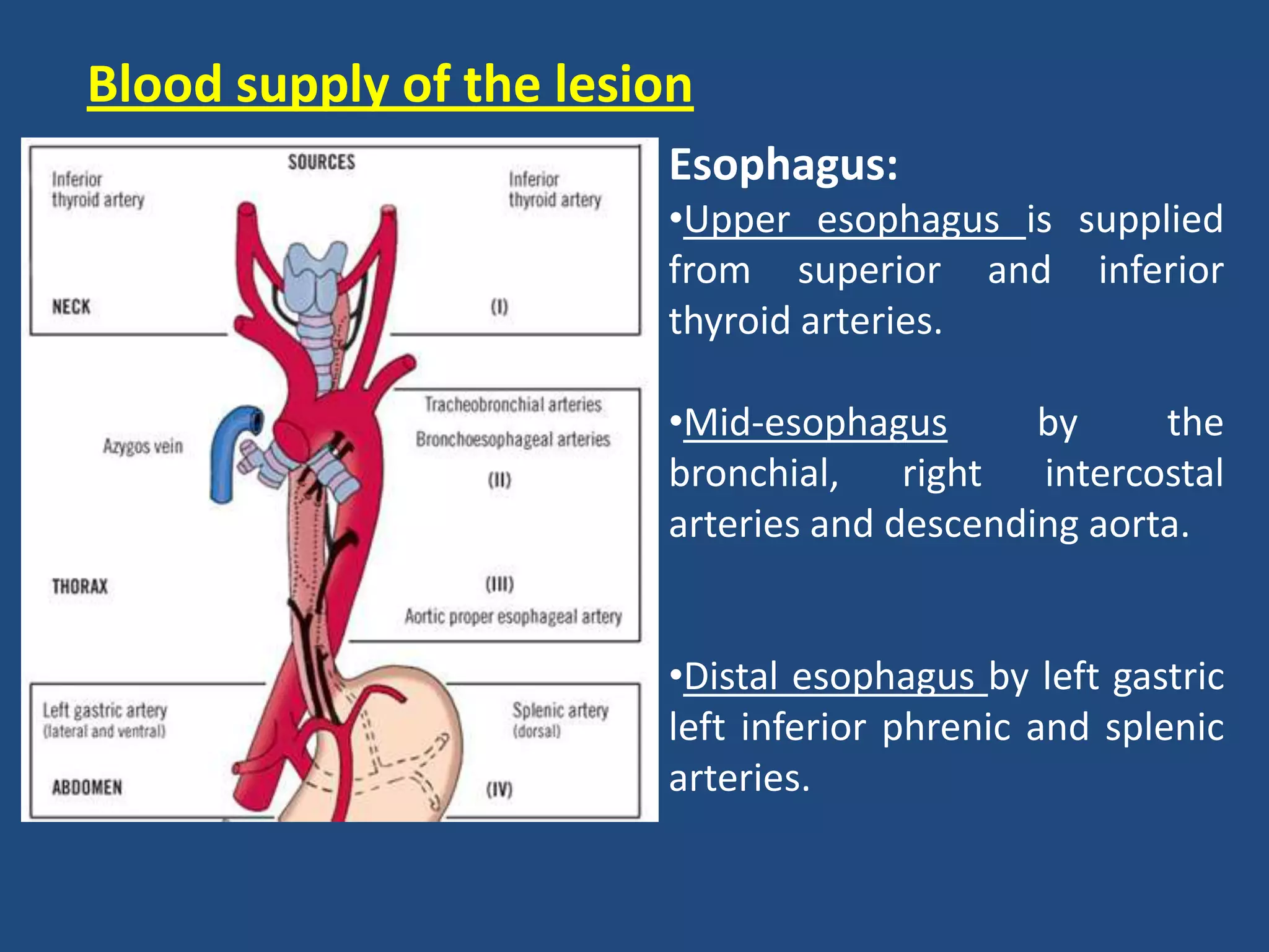 Upper GI bleed Approach and Management | PPTX