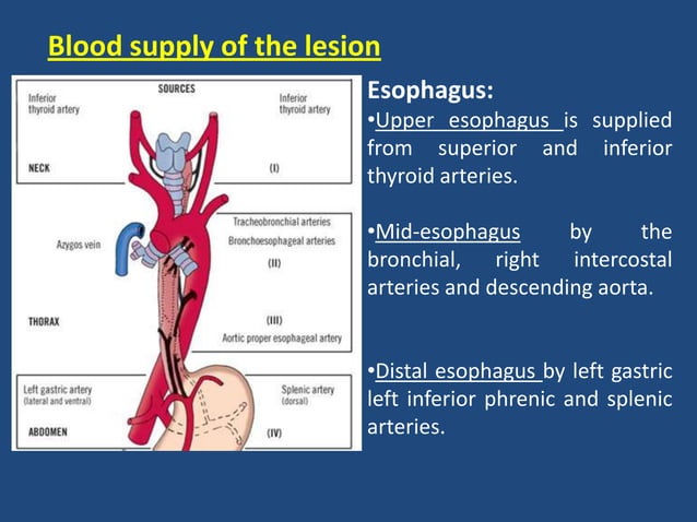 Upper GI bleed Approach and Management | PPTX