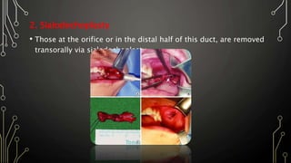 Management salivary gland disease .pptx