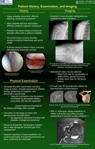 Management of Glenohumeral Osteoarthritis in Young Patients | PPTX