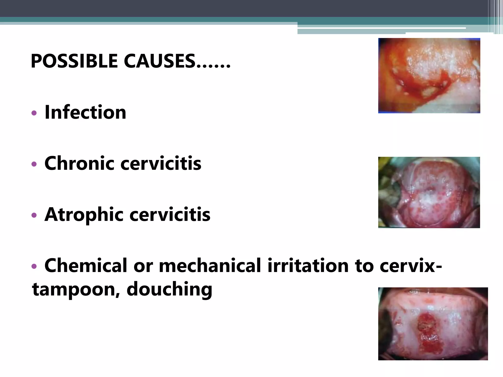 Management of abnormal cervical smear | PPTX
