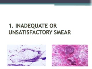 Management of abnormal cervical smear | PPTX