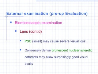 Management of adult cataract II.ppt