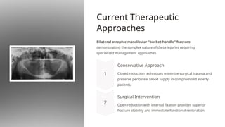 Management-of-Atrophic-Mandible-Fractures.pptx