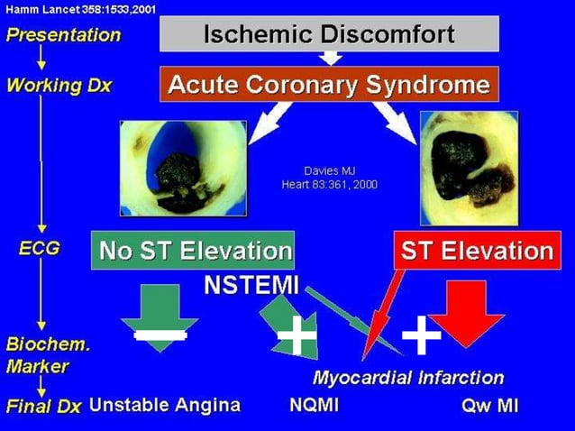 Management-of-CAD.ppt | Heart and Cardiovascular Diseases | Diseases ...