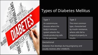 Management-of-Diabetes-Mellitus lastpptx | PPTX