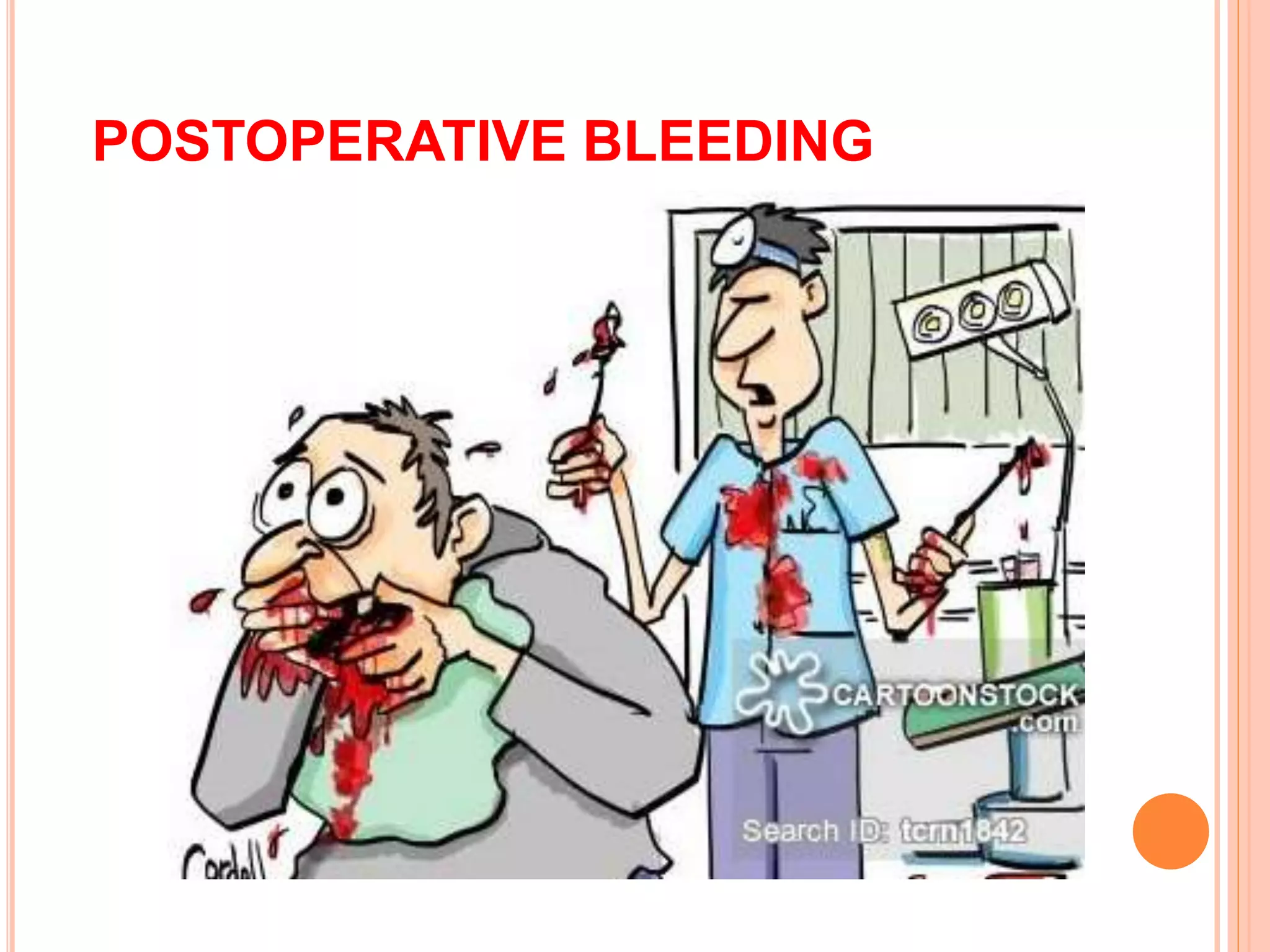 Management of-extraction-complications | PPSX