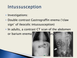 Intussusception Barium Enema Claw Sign