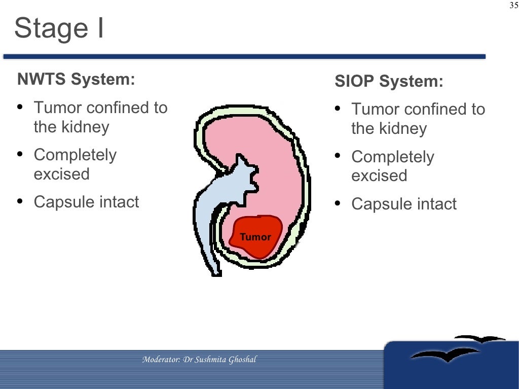 Management Of Wilms Tumors