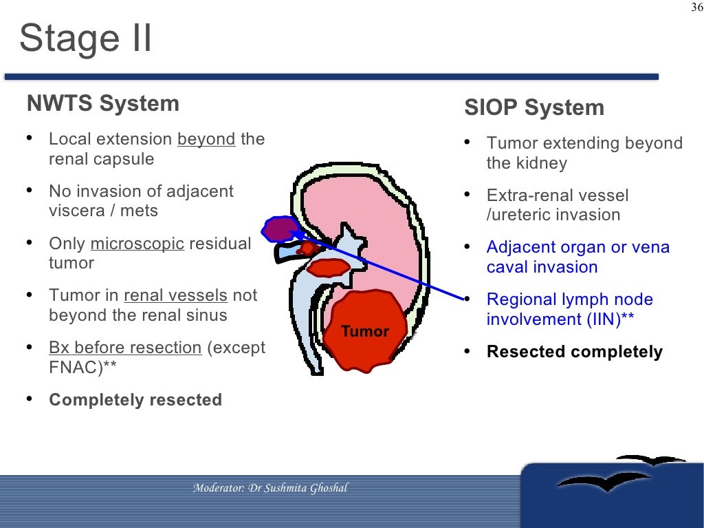 Management Of Wilms Tumors
