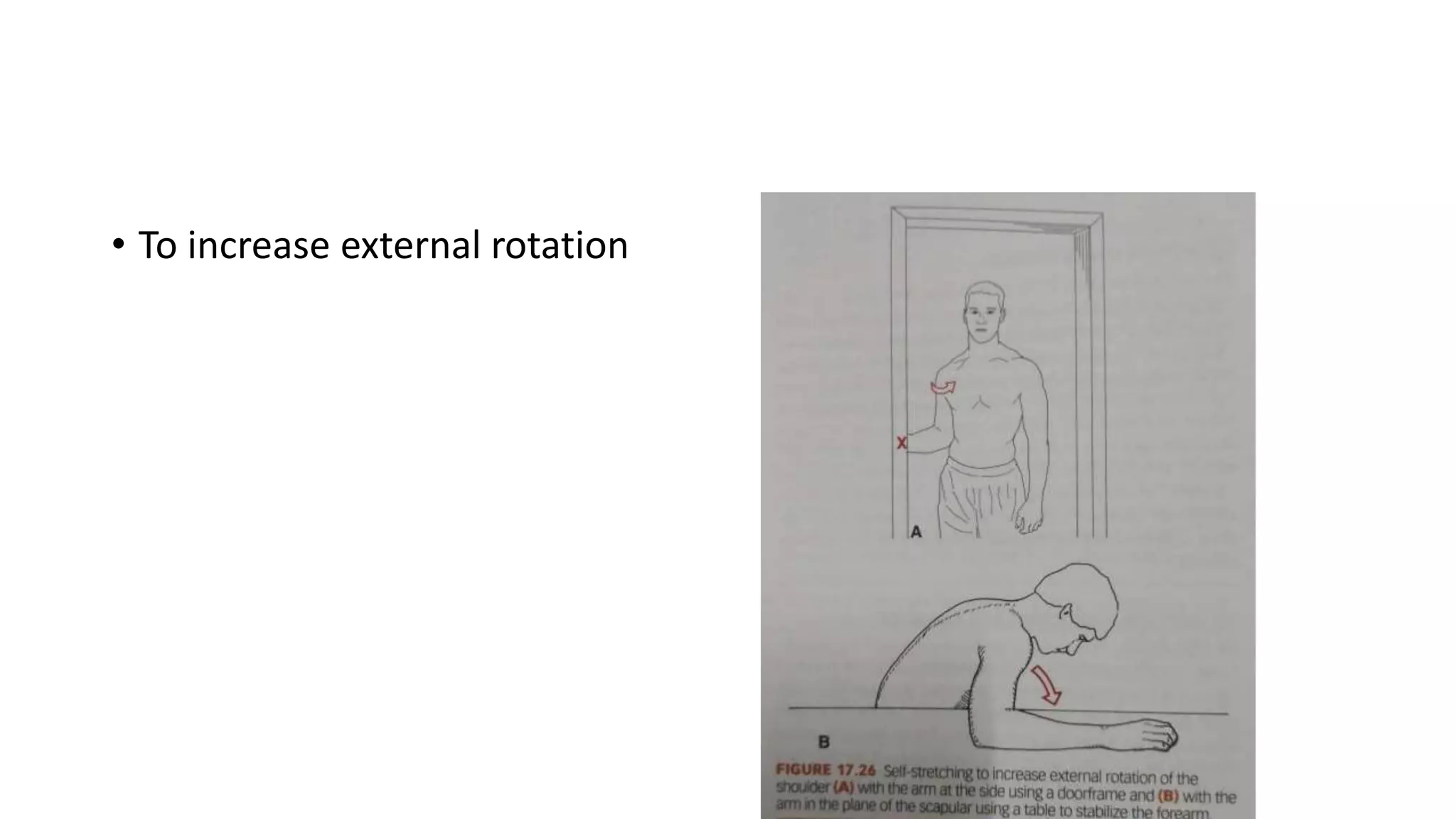 Frozen Shoulder Physiotherapy Management | PPTX