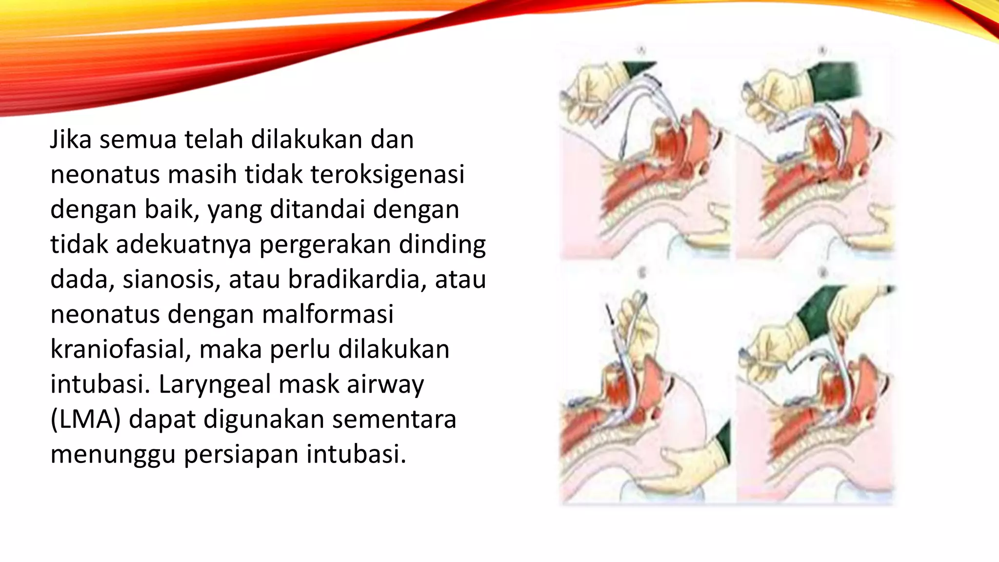 Management Airway PPT.pptx