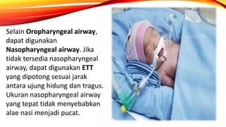 Management Airway PPT.pptx