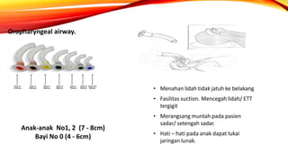 Management Airway PPT.pptx