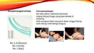 Management Airway PPT.pptx