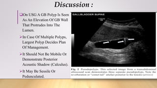 Management and follow up of gallbladder polyps | PPTX