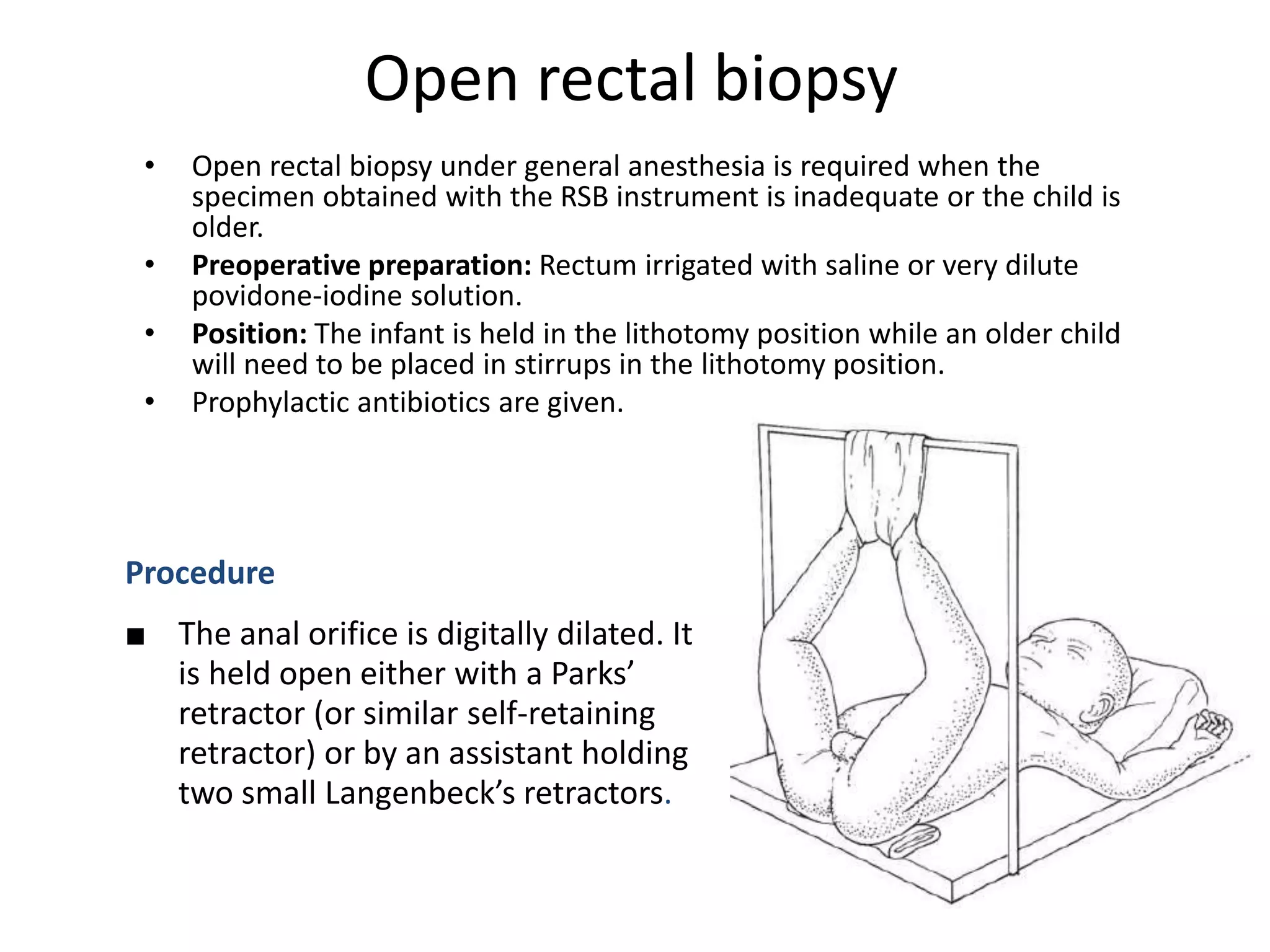 Management and surgical procedures of Hirschsprung disease | PPTX