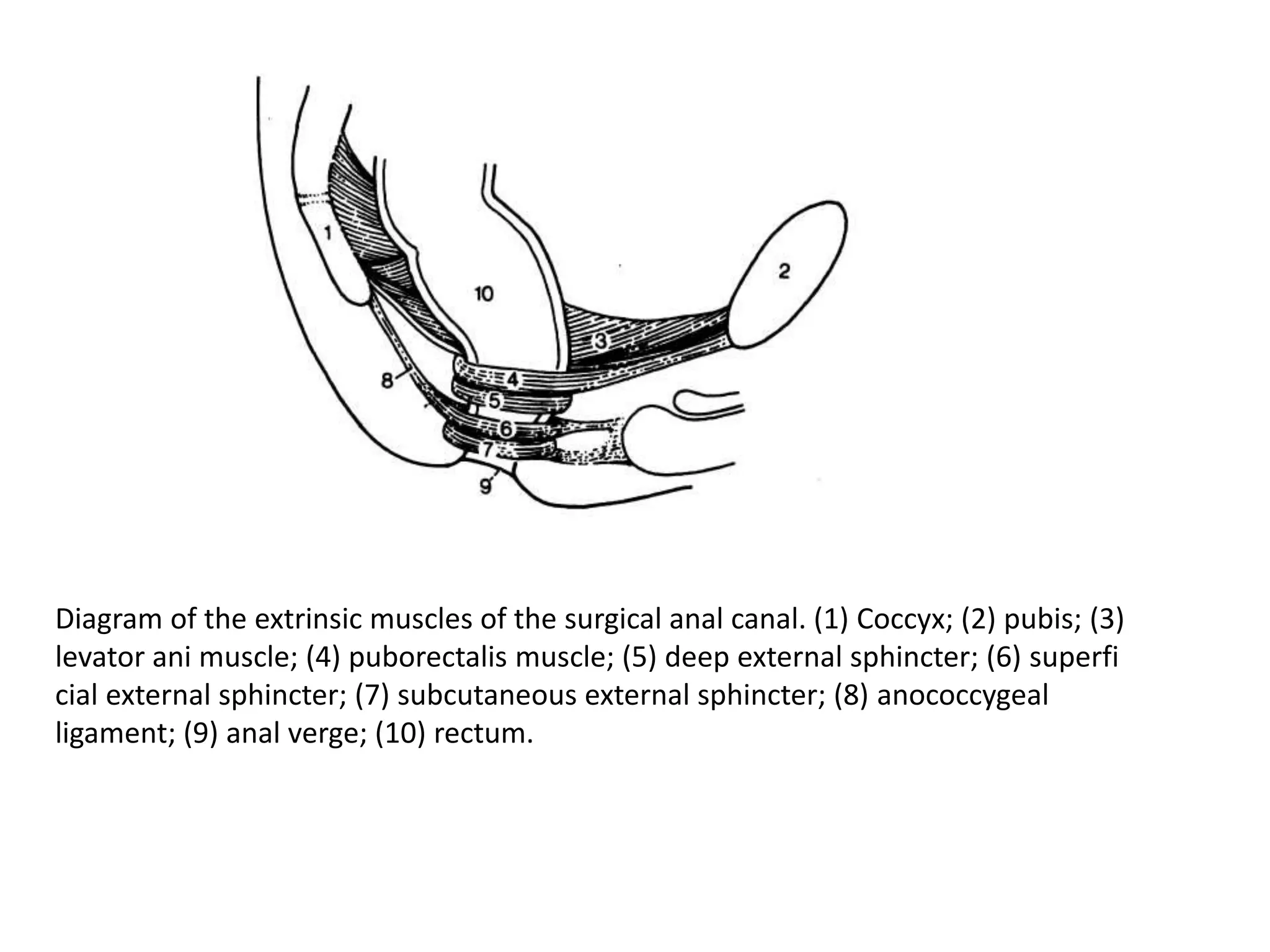 Management and surgical procedures of Hirschsprung disease | PPTX