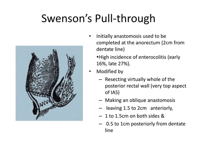 Management and surgical procedures of Hirschsprung disease | PPTX | Digestive Disorders ...