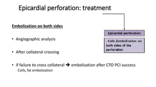 Perforation management collaterals | PPTX