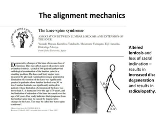 Management dilemma when knee osteoarthritis coexists with Spine.pptx