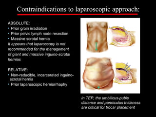 Management of Giant Scrotal Hernia | PPT