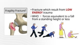 Management Lower Extremity Fragility Fracture.pptx