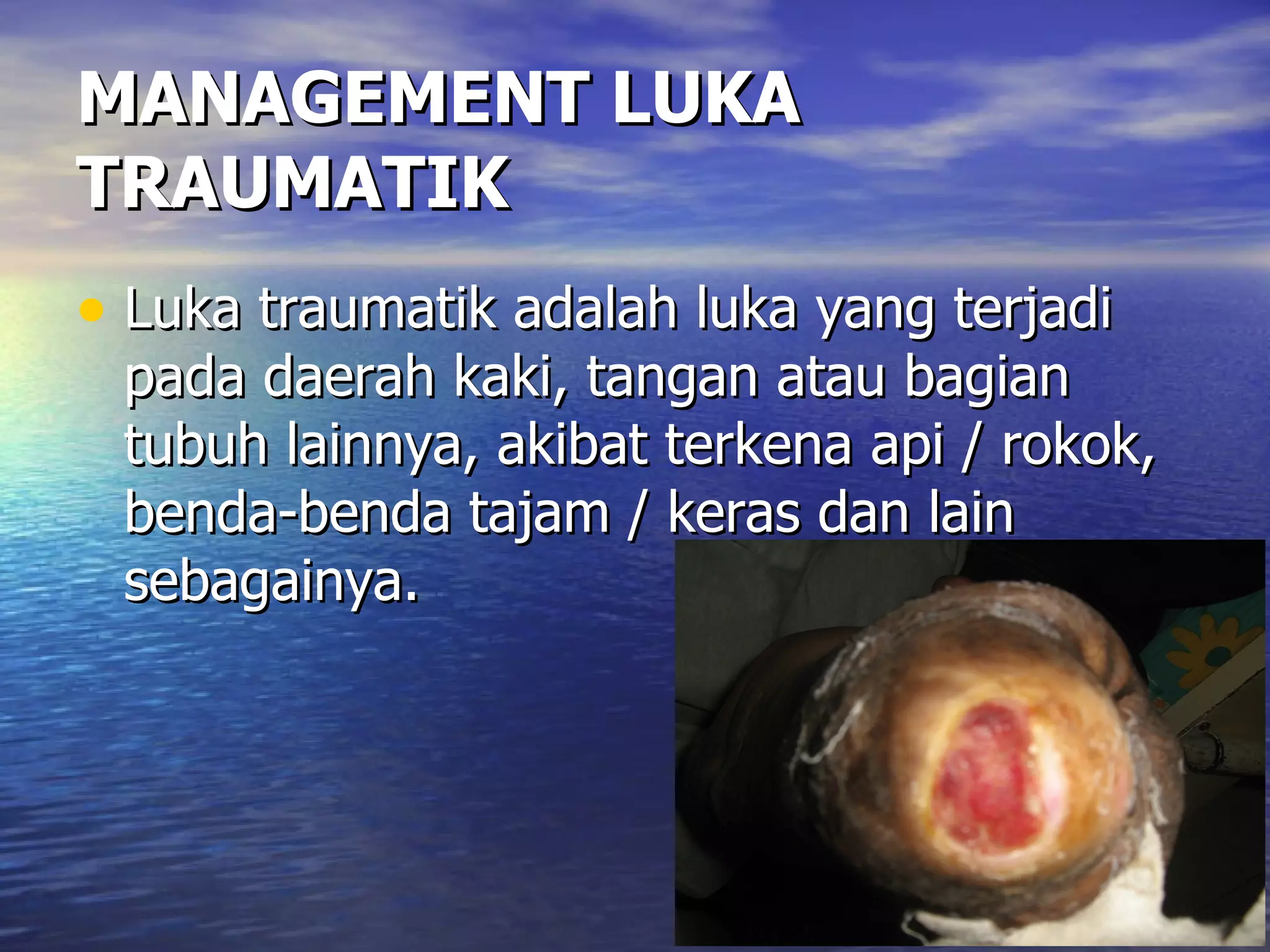 Management Luka | PPT