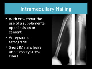 Management of metastatic bone disease | PPT
