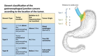 MANAGEMENT OF GEJ GASTRO ESOPHAGEAL JUNCTION (3).pptx