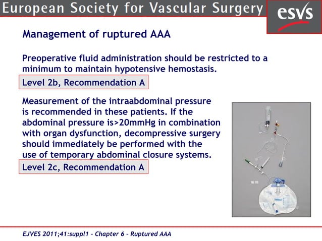 Management of aaa clinical practice guidelines of the esvs | PPT