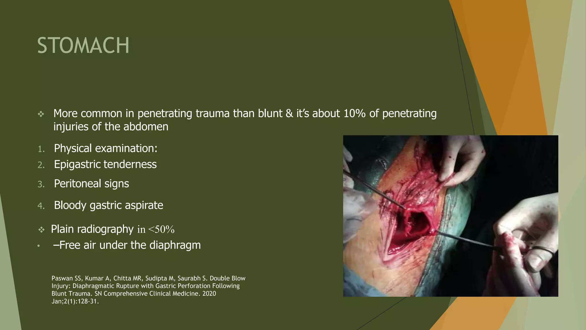 MANAGEMENT OF ABDOMINAL TRAUMA.pptx