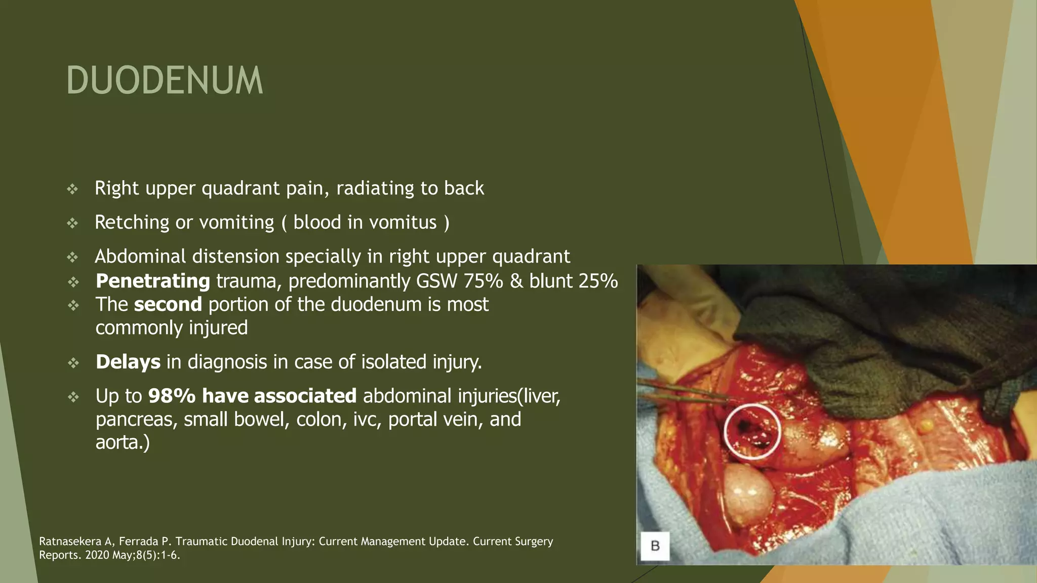 MANAGEMENT OF ABDOMINAL TRAUMA.pptx