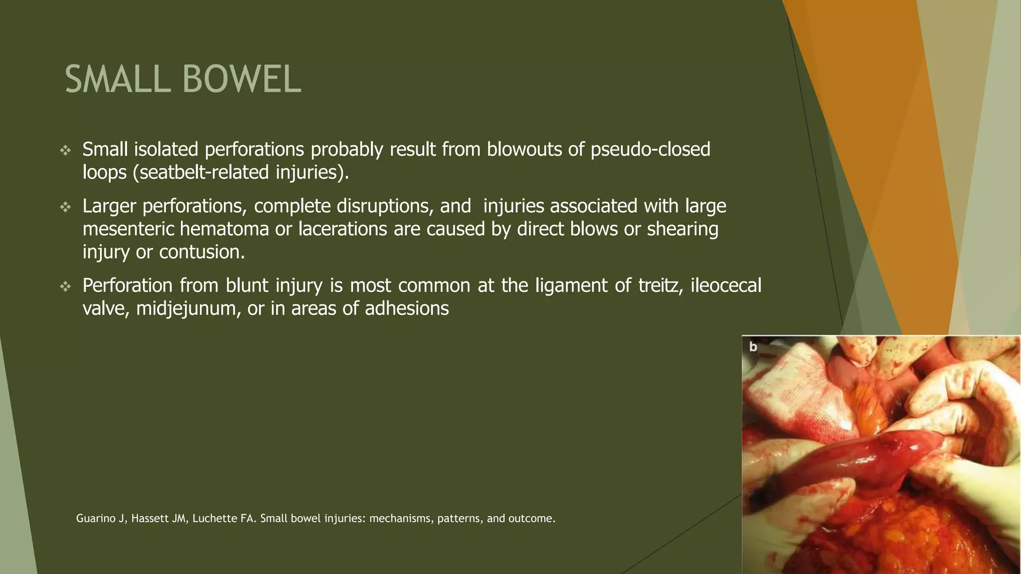 MANAGEMENT OF ABDOMINAL TRAUMA.pptx