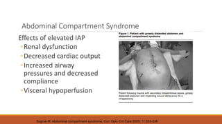 Management of abdominal trauma | PPTX