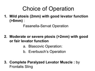 Management of a Case of Ptosis management of case of ptosis | PPTX