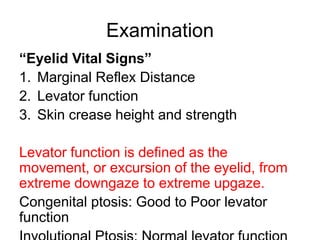 Management of a Case of Ptosis management of case of ptosis | PPTX