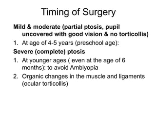 Management of a Case of Ptosis management of case of ptosis | PPTX