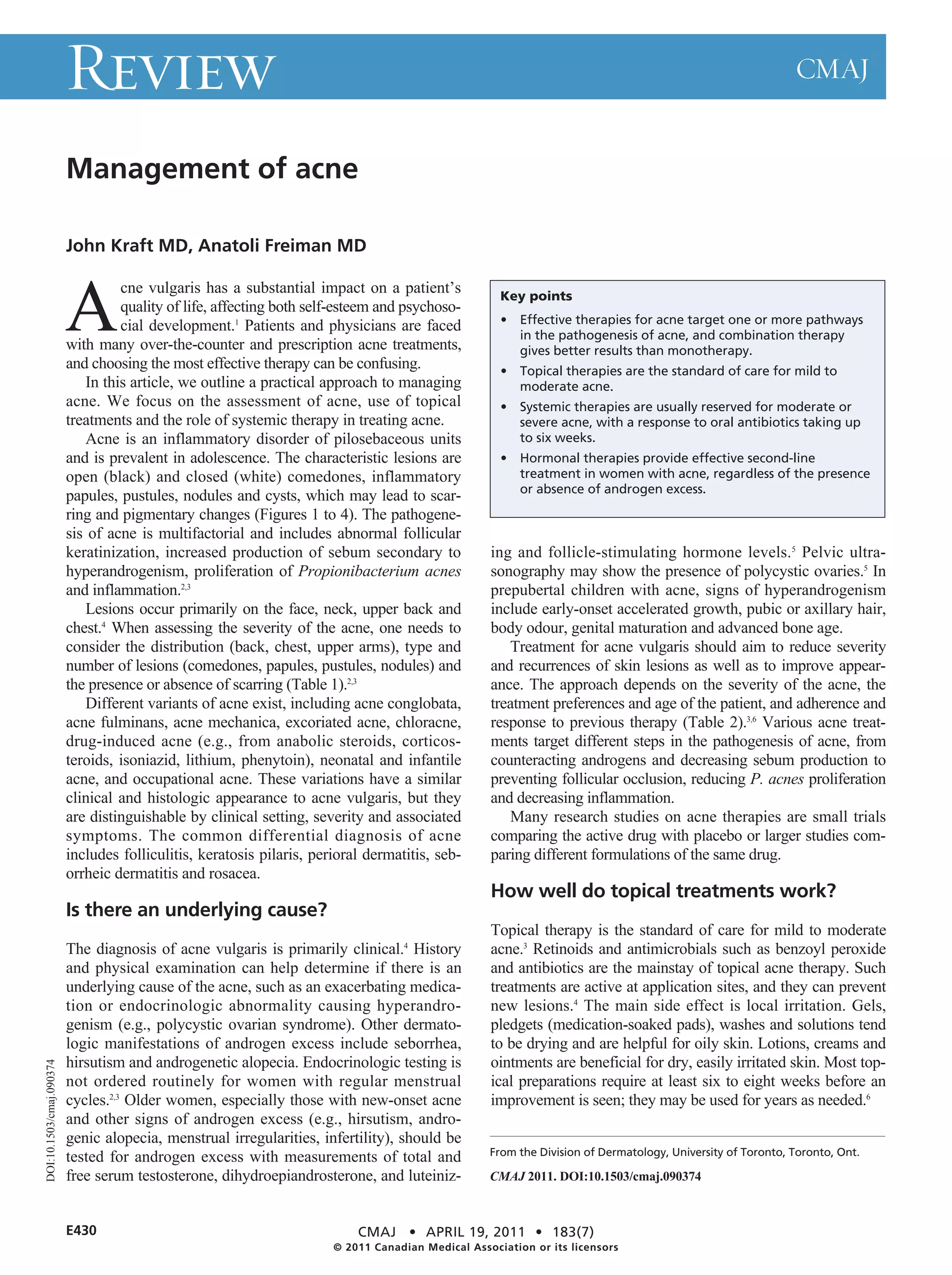 Management of acne | PDF