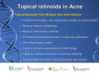 Management of Acne : Part - 5 | PPT