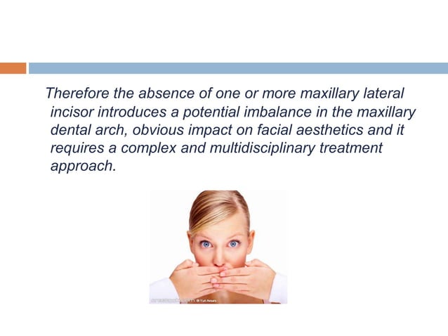Management of a congenitally missing lateral incisors | PPTX | Dental ...