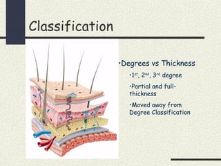 Management of acute burns | PPS
