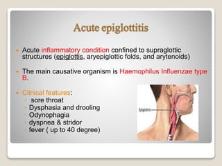 Management of acute epiglottitis | PPT