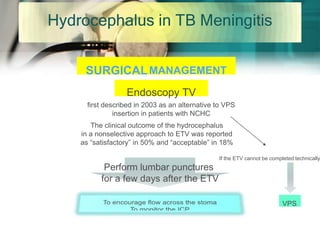Management of acute hydrocephalus | PPT