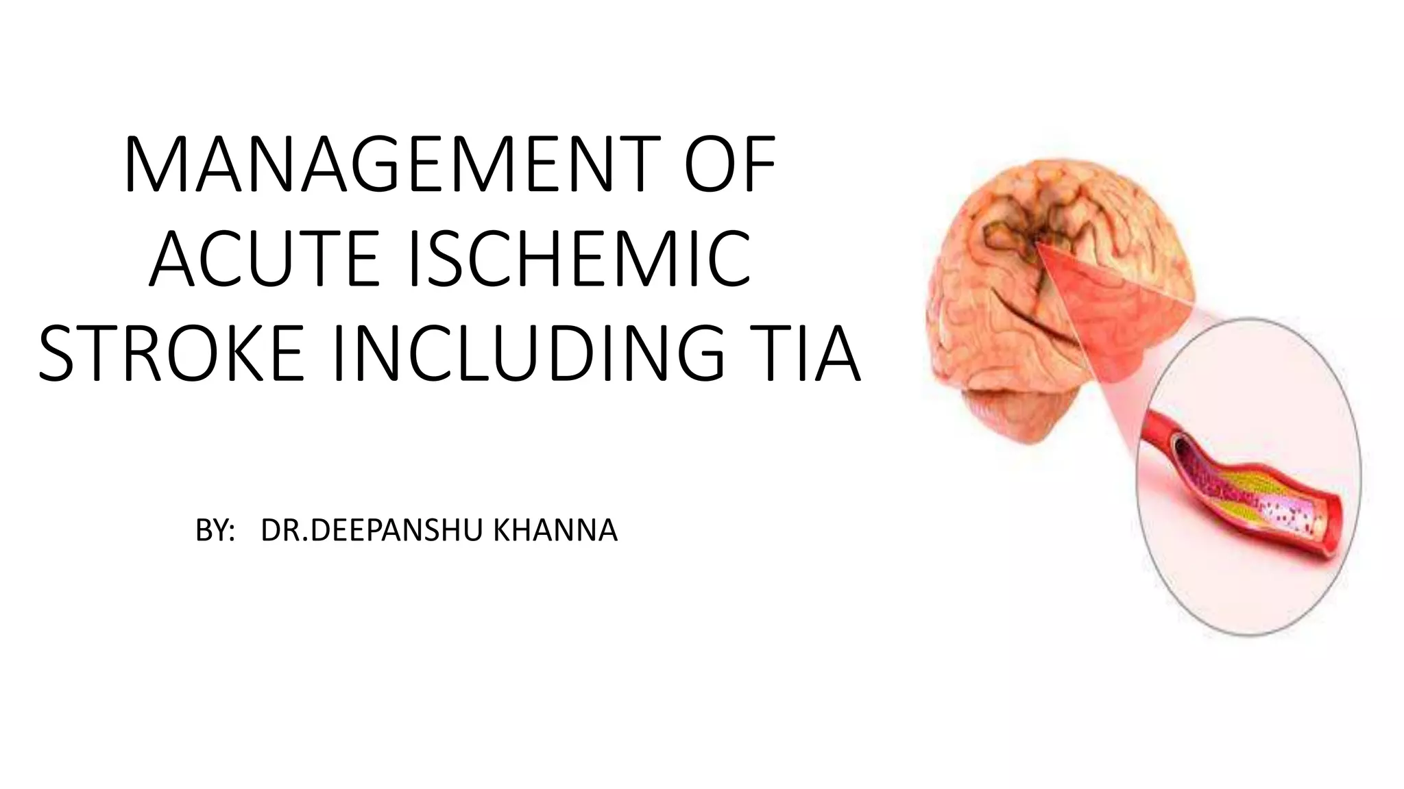 Management of acute ischemic stroke including tia [autosaved] | PPTX
